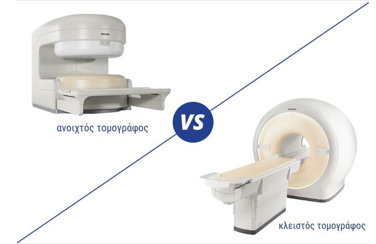 Μαγνητική Τομογραφία - ΑΠΕΙΚΟΝΙΣΤΙΚΗ ΧΑΛΑΤΣΗ ΑΕ
